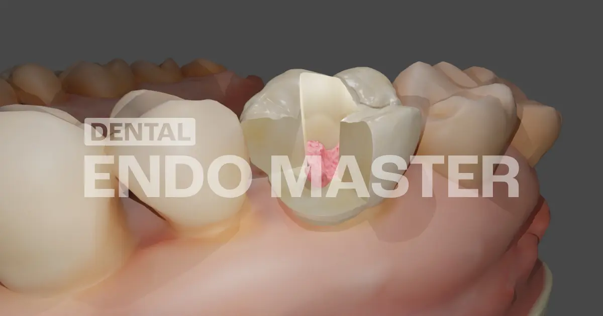ENDOMASTER - Dental Master Series